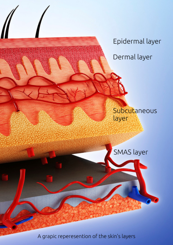 What's the difference between Ultherapy and Ultraformer III?